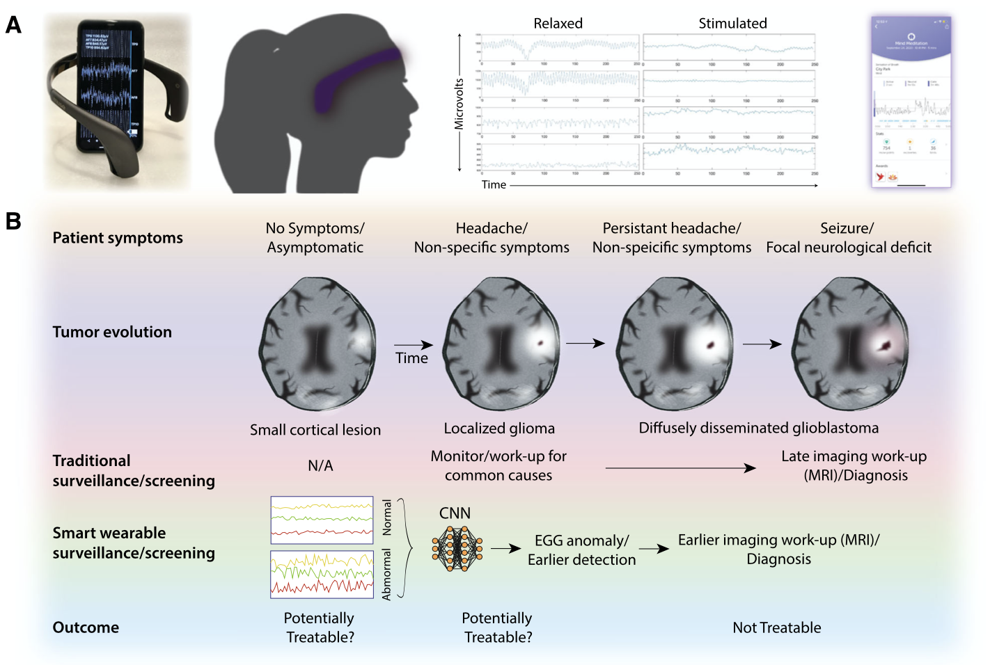 Could wearable technology help detect deadly brain cancers early on?