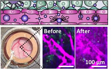 Nanobubbles can exit vascular system intact, bringing ultrasound-based ...